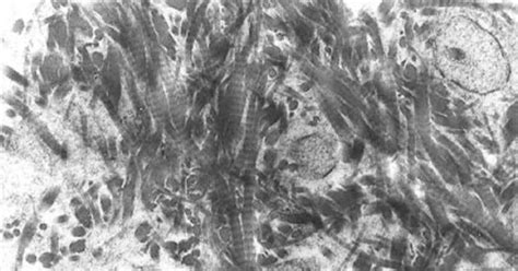 Bone Matrix What It Is Components And Characteristics Psychology