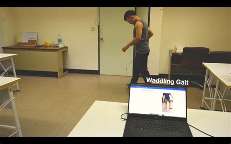 Iot Based Wearable Device Offers Affordable And Portable Gait Analysis For The Early Detection