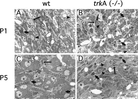 One Micrometer Semithin Plastic Sections Of Scgs Of Wild Type And Trka