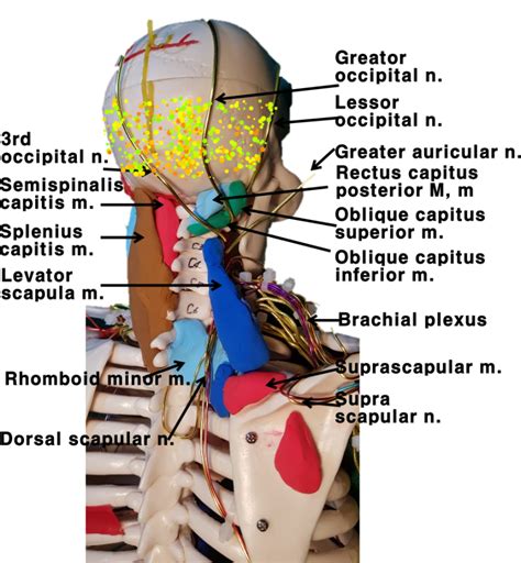 Suboccipital Muscles Trigger Points