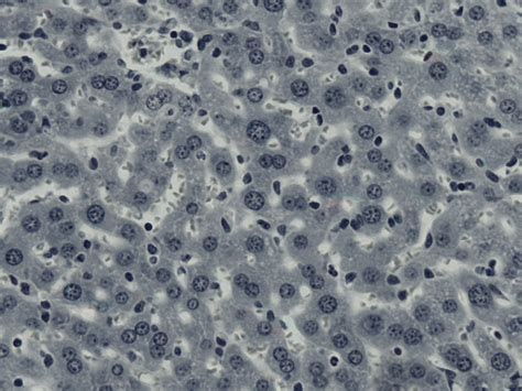 Toxoplasma Gondii Liver Slide Prepared Slides