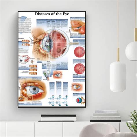 Eye Diseases Chart