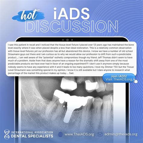 Iads Iadshotdiscussion Iadsmembership Iadsmember Dentalspecialists