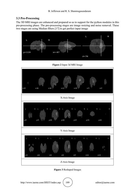 Brain Tumor Classification In 3d Mri Using Features From Radiomics And 3d Cnn Combined With Knn