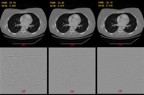 Reconstruction Results And Error Maps Of Different Wavelet Domain Based