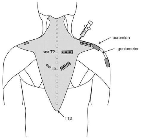 Surface Emg Signals Were Detected From The Upper Mid And Lower Download Scientific Diagram