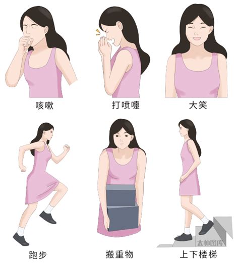 尿失禁 医学插画