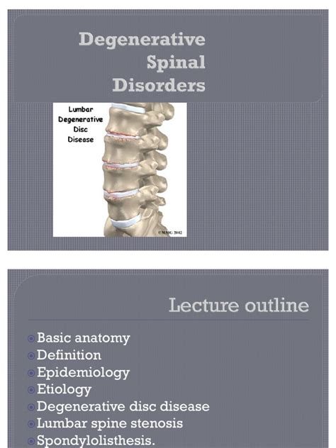 Degenerative Spinal Disorders Vertebral Column Musculoskeletal System