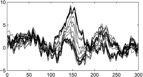 Channel EEG Measurements Download Scientific Diagram