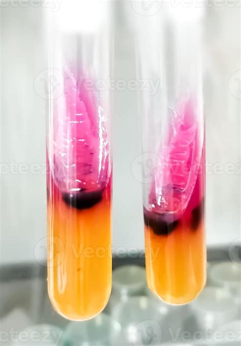 Salmonella Detection Method By Using Triple Sugar Iron Or Tsi Agar In
