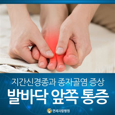 발바닥 앞쪽 통증 지간신경종과 종자골염 네이버 블로그