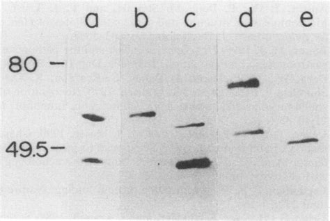 Immunoblot Analysis Of Bacterial Preparations With Mouse Monoclonal Download Scientific Diagram