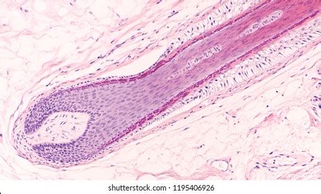 Follicle Scalp Images Stock Photos Vectors Shutterstock