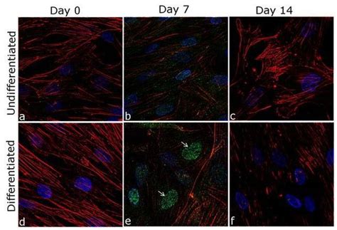 Runx2 Recombinant Superclonal Antibody 6hclc 711519