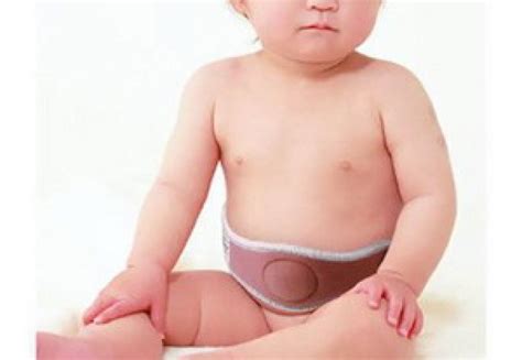 Пупочная грыжа у детей признаки причины симптомы лечение и профилактика Idoctor Kz