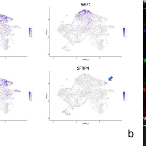 umap plot of scrna seq reclustering of fibroblasts and heatmap of