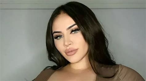 Rare Condition Causes Womans Boobs To Grow Six Cup Sizes In 14 Months