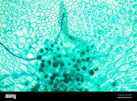 Fern Sporophyte Microscope Theobrominated Gametophytes