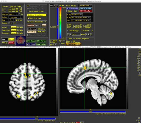 Fmriprep Tutorial 6 Group Analysis — Andys Brain Book 1 0 Documentation