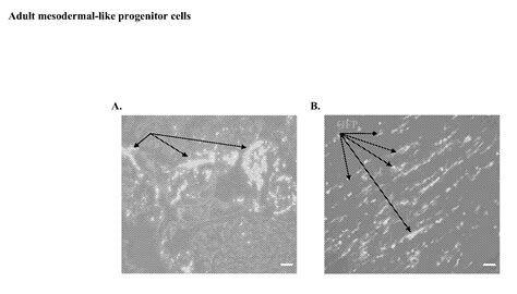 Mesodermal Like Cell Population For Treating Ischemia In Mammals Eureka Patsnap