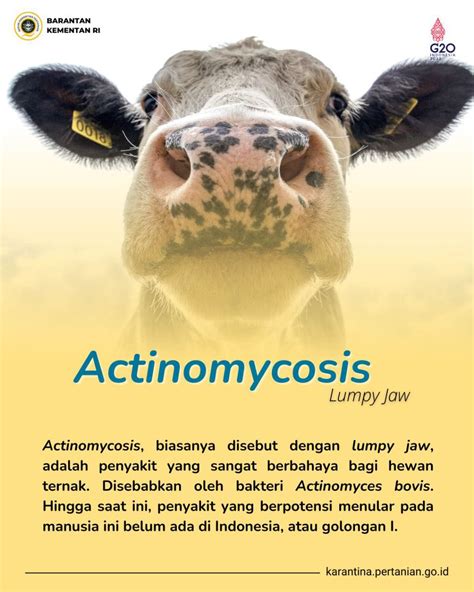 Actinomyces Lumpy Jaw