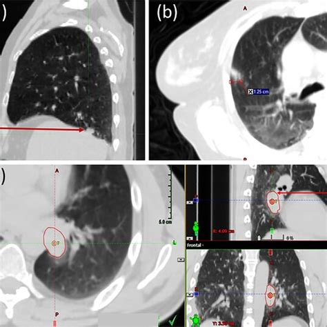 Examples Of Relatively Normal Respiratory Signals From Varians Download Scientific Diagram
