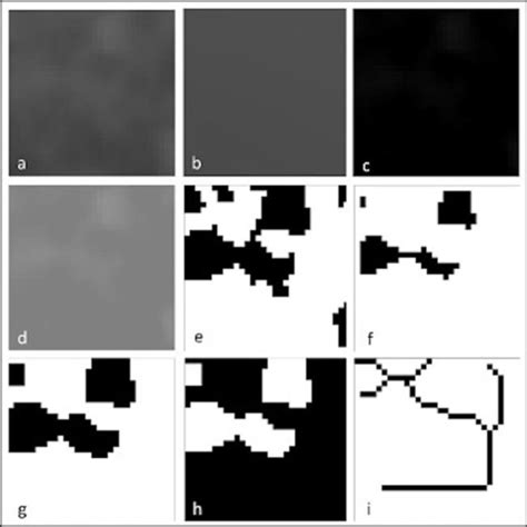 Stages Of Fractal Dimension Analysis A Cropped Roi B Gaussian Download Scientific Diagram