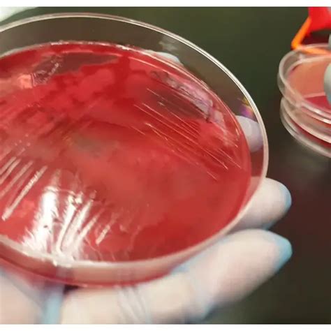 Book Culture Clostridium Test Price In Delhi Ganesh Diagnostic