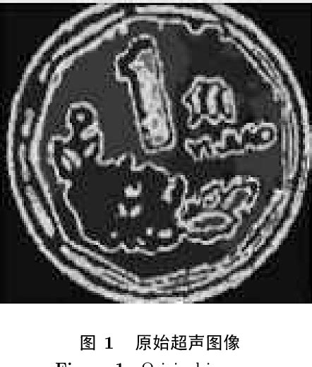 Figure 1 From The Performance Of Reconstruction Ultrasound Imaging Based On Compressed Sensing