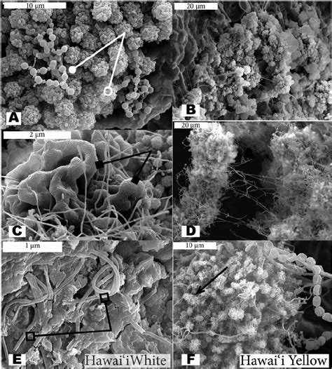 Scanning Electron Micrographs Sem Of White Left Column And Yellow