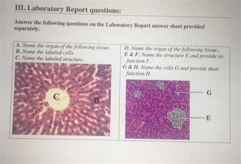 Solved III Laboratory Report Questions Answer The Chegg