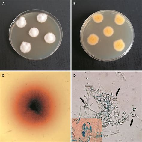 Micro And Macroscopic Morphology Of Isolated Dermatophytes Nikon