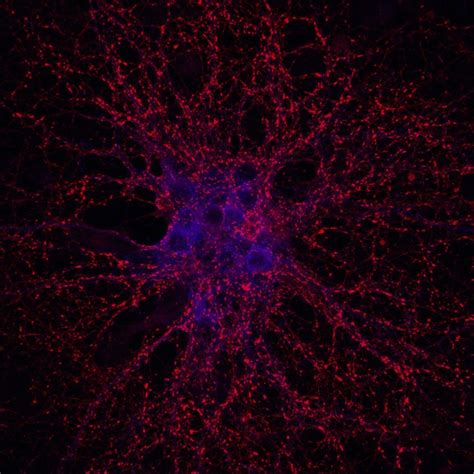 Mbf Bioscience On Linkedin Neuroart Neuroscience Sciart Imagecontest