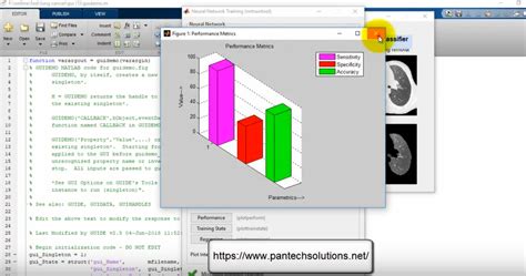 lung cancer detection using matlab