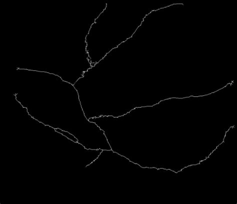 After Application Of The Removing Unwanted Pixels Technique To The Download Scientific Diagram