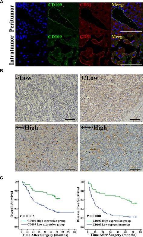 Reduced Expression Of Cd109 On Tumor Vessels Correlated With Poor Download Scientific Diagram