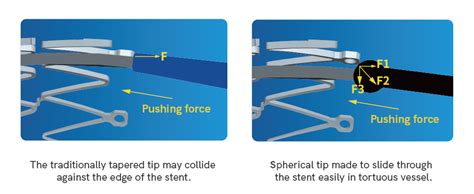 Conqueror™ Lollipop Nc Ptca Balloon Catheter Apt Medical