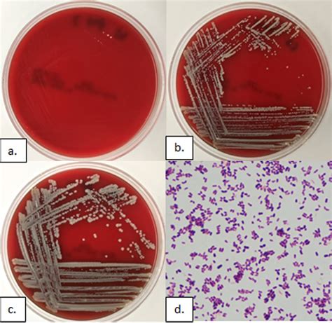 Corynebacterium Diphtheriae Colony Morphology