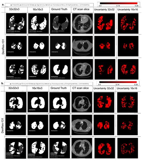 The Multi Classification Results Of Six Different Patients Of The