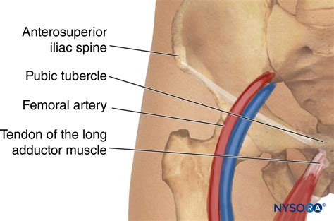 Obturator Nerve Block Landmarks And Nerve Stimulator Technique Nysora