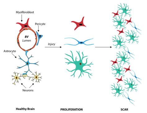 Cartoon Depicting The Role Of Astrocytes In The Healthy And Injured Download Scientific Diagram