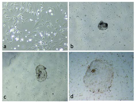 A Icr Mouse Embryonic Fibroblasts Mef Feeder Cells B Seeding Of