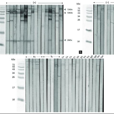 Sds Page Protein Patterns Of Cwas Of Platynosomum Fastosum Cwas 15