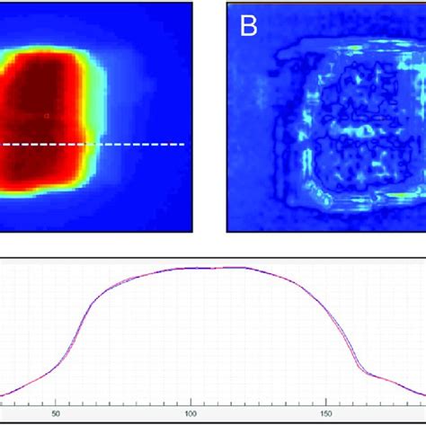 Online Workflow Of The Mri Linac Treatment The Online Mri Is