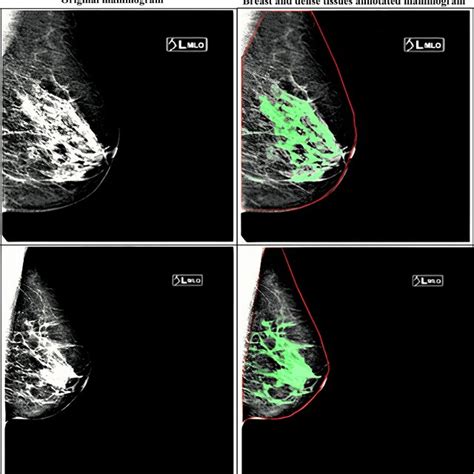 Examples Of Generated Ground Truth Segmentation Masks From The Kuh Download Scientific Diagram