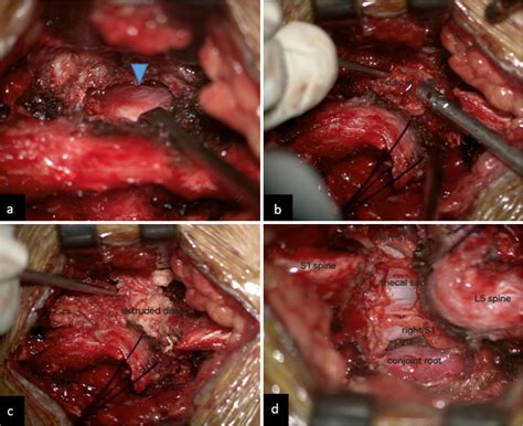 Surgical Neurology International
