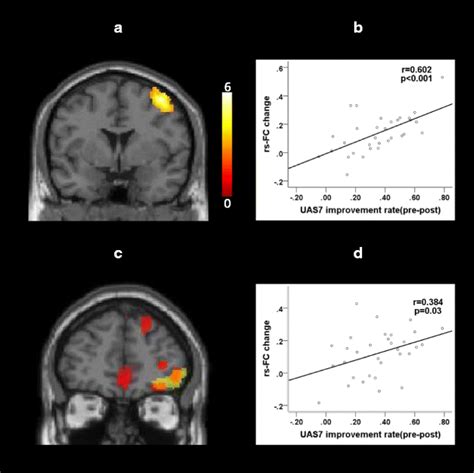 Resting State Functional Connectivity Results A After A Comprehensive