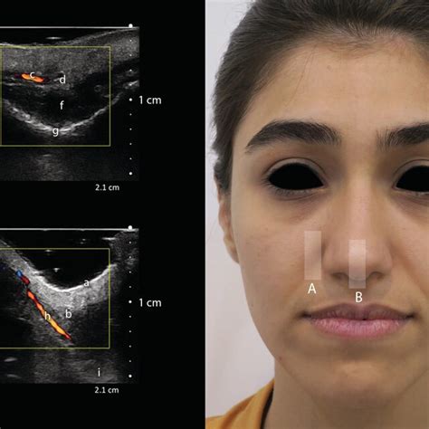 Patient At The Referral To Our Clinic With Malocclusion And