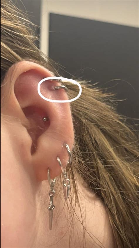 Weird Bump Keeps Returning Rpiercing