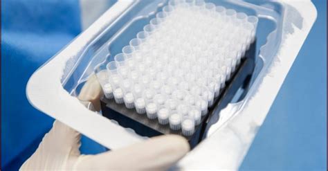 Улаанбаатар хотод бүртгэгдсэн тарваган тахал өвчний сэжигтэй гурван хүний шинжилгээний хариу